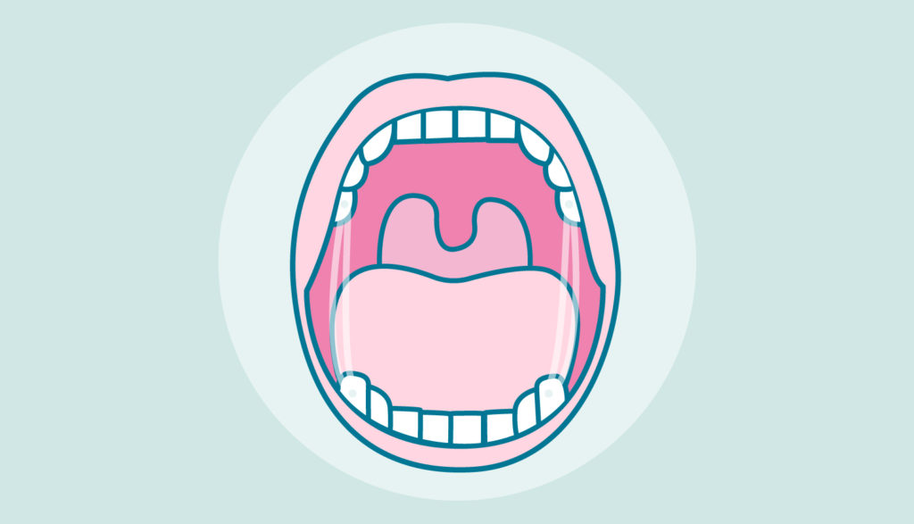 Invisalign y el uso de las gomas - Clínica Dental Soria Vizcaíno